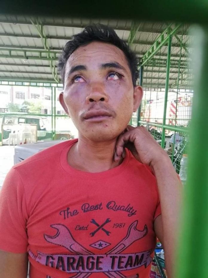 Helpless Man Suffers Wounds & Injuries After Allegedly Mauled by Guards