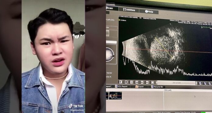 GABO ADEVA - Content Creator to Undergo Eye Removal Surgery After Being Diagnosed With Stage 2 ...