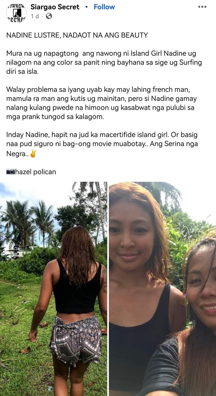 Nadine Lustre Calls Out Owner of 'Siargao Secret' Page for Claiming Her Skin is Ruined