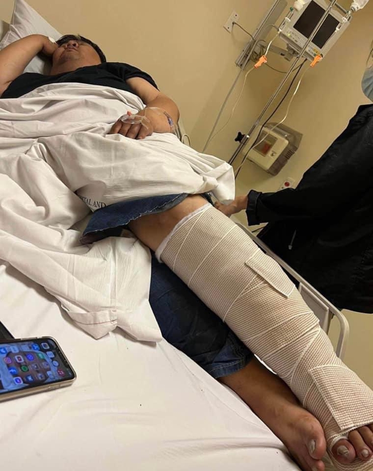 It's Showtime's Audience Coordinator Dumbo Figured in a Motorcycle Accident