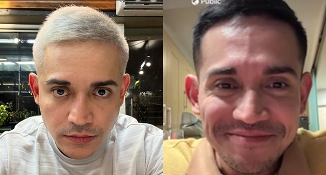 Netizens Notice Changes in Paolo Contis' Appearance | Newspapers