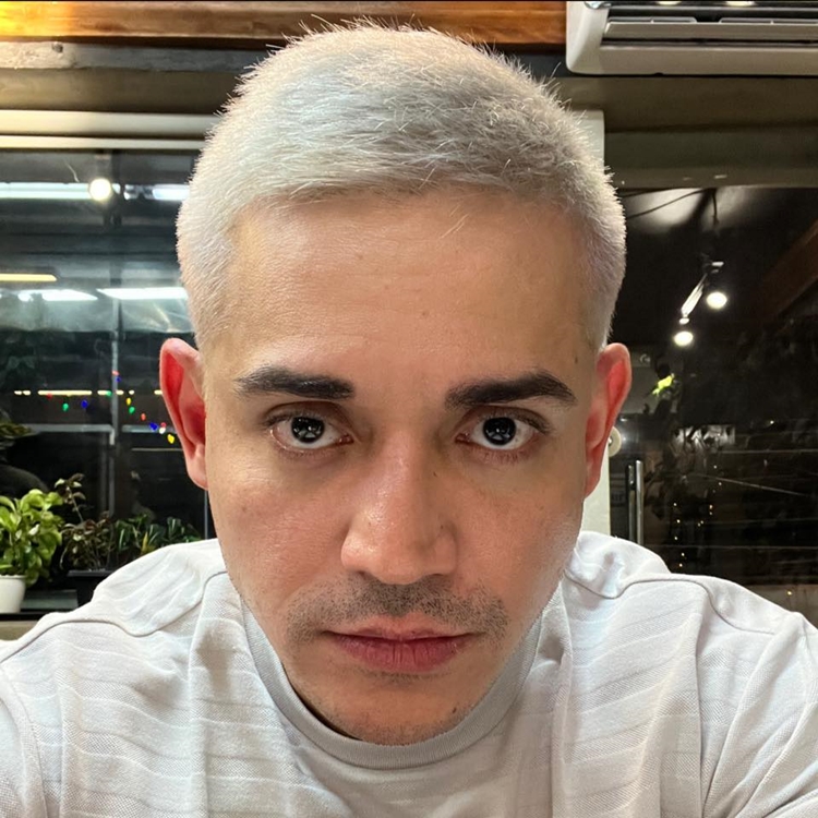 Netizens Notice Changes in Paolo Contis' Appearance | Newspapers