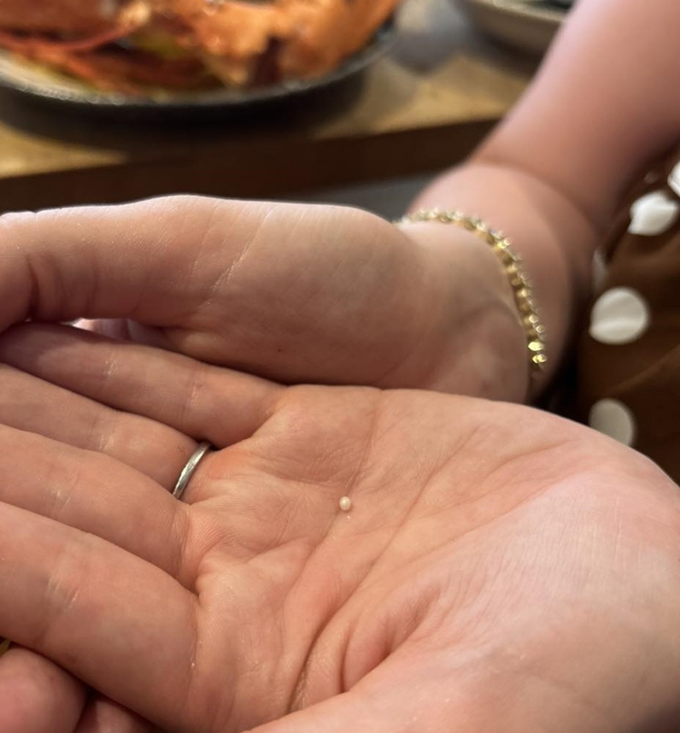Customer Finds a Rare Pearl While Eating Mussels at a Restaurant ...