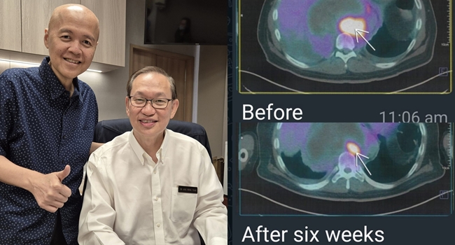 Doc Willie Ong Gives an Update About His Health: Sarcoma Shrinks by 60% ...