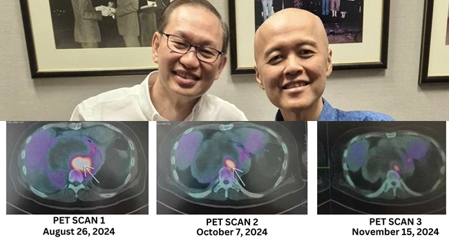 Doc Willie Ong Shares Latest Health Update | Newspapers