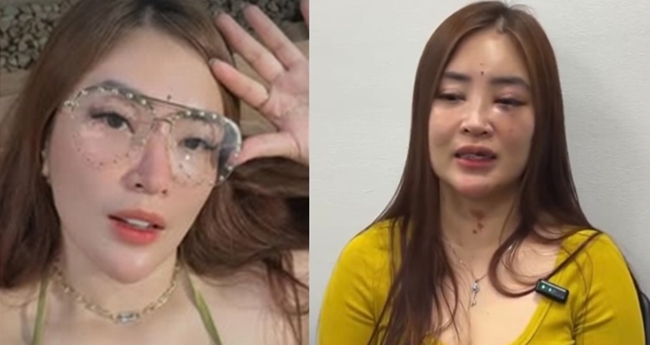 Jellie Aw Posts Update after Mauling Incident with Jam Ignacio | Newspapers