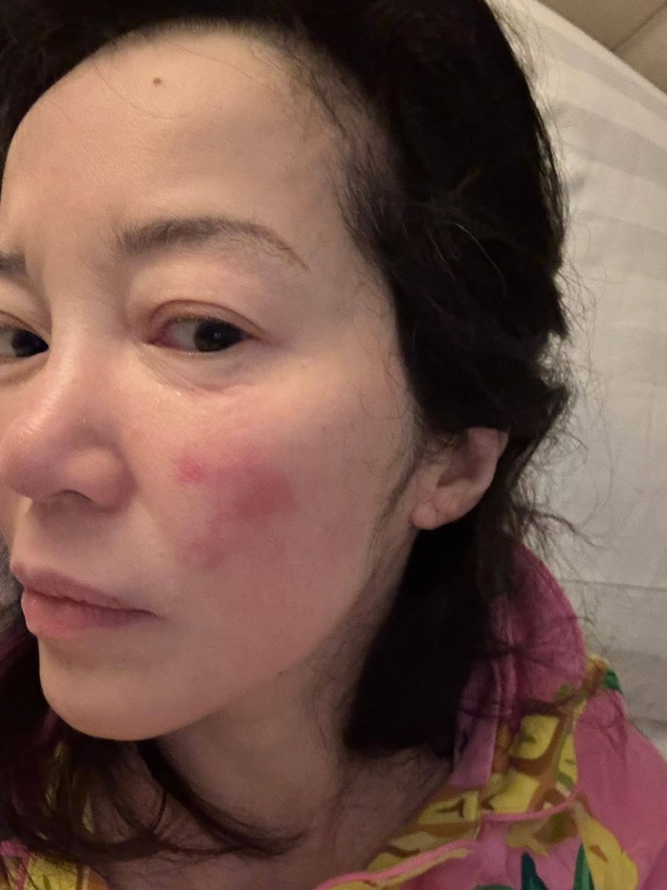 Dindo Balares Shares the Latest Update on Kris Aquino’s Health | Newspapers