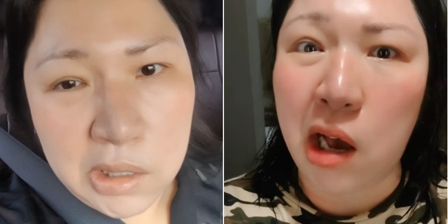 Frenchie Dy Breaks Silence on Bell’s Palsy—Reveals Health Update ...