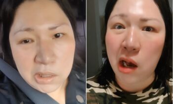 Frenchie Dy Breaks Silence on Bell’s Palsy—Reveals Health Update ...