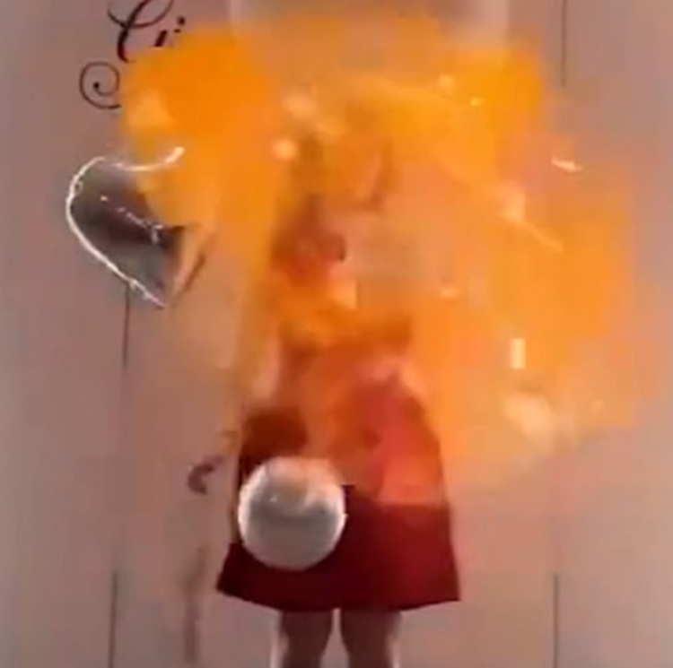 Birthday Balloons Explode, Injuring Celebrant | Newspapers