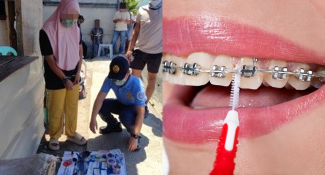 Fake Dentist Caught After Offering Braces for Only ₱1,000 | Newspapers