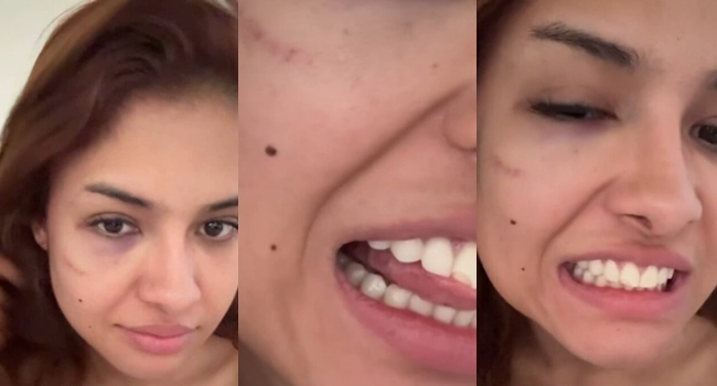 Rabiya Mateo Suffers Minor Injuries During Wakeboarding Accident ...