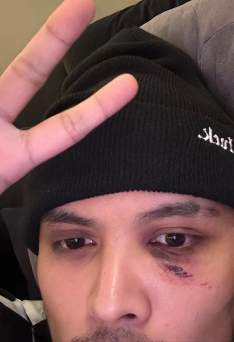 Jolo Estrada Defends His Brother Julian After Being Beaten in Boracay ...
