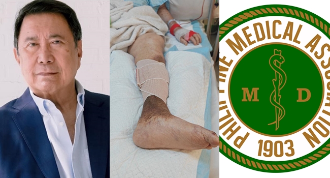 Ramon Tulfo Condemned by PMA for Publicly Shaming a Doctor | Newspapers