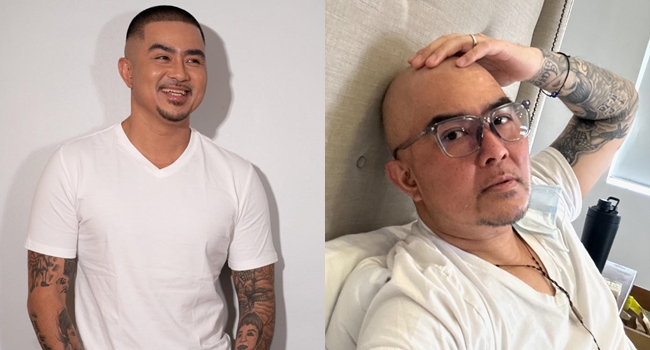 Pambansang Kolokoy Joel Mondina Speaks Out After “Cancer Karma ...