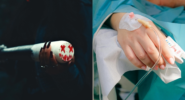 Teen Comatose After Being Struck with Baseball Bat | Newspapers